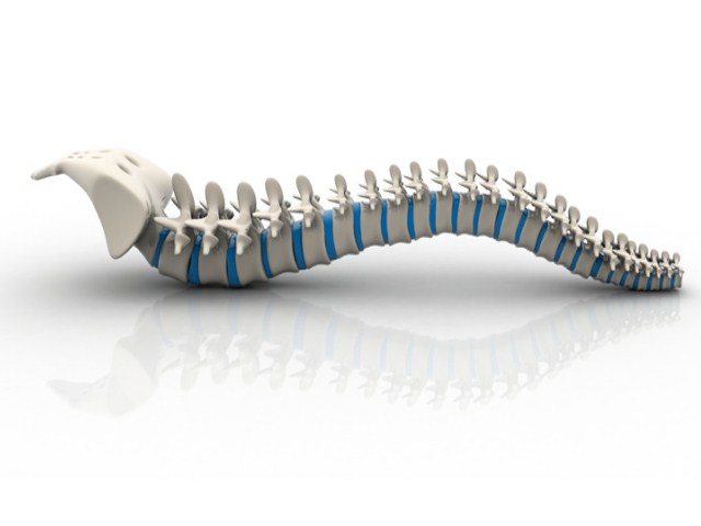 Kypho scoliosis, kyphosis, kyphoplasty / Spine curvature