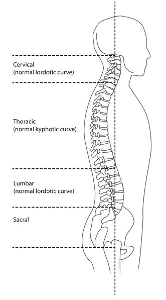 Spine curvature! Kypho scoliosis, kyphosis, kyphoplasty
